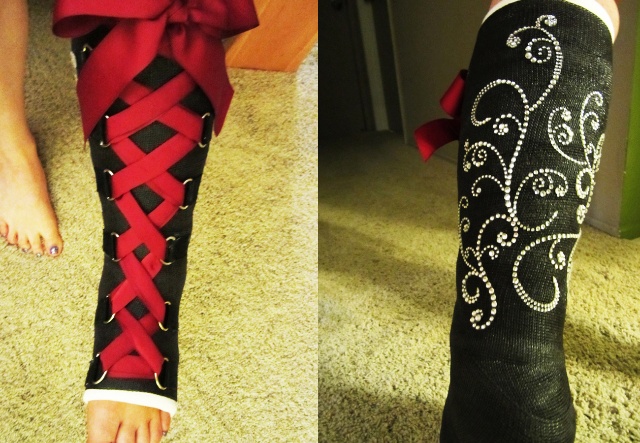 Pin by Kelsey Bell on DDH | Bow legged correction, Leg cast, Legs