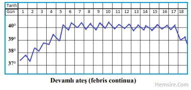 Ateş tipleri ve grafikleri