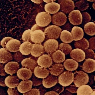 saude-Estafilococos bacteria que e um desafio constante a medicina ...