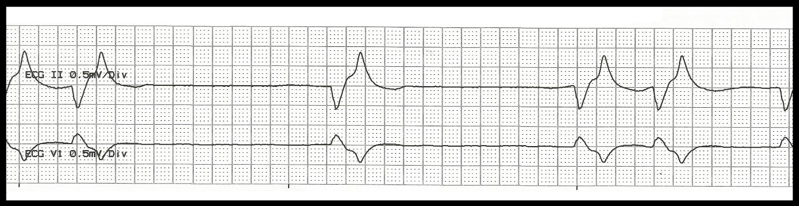 Practice EKG Rhythm Strips 188