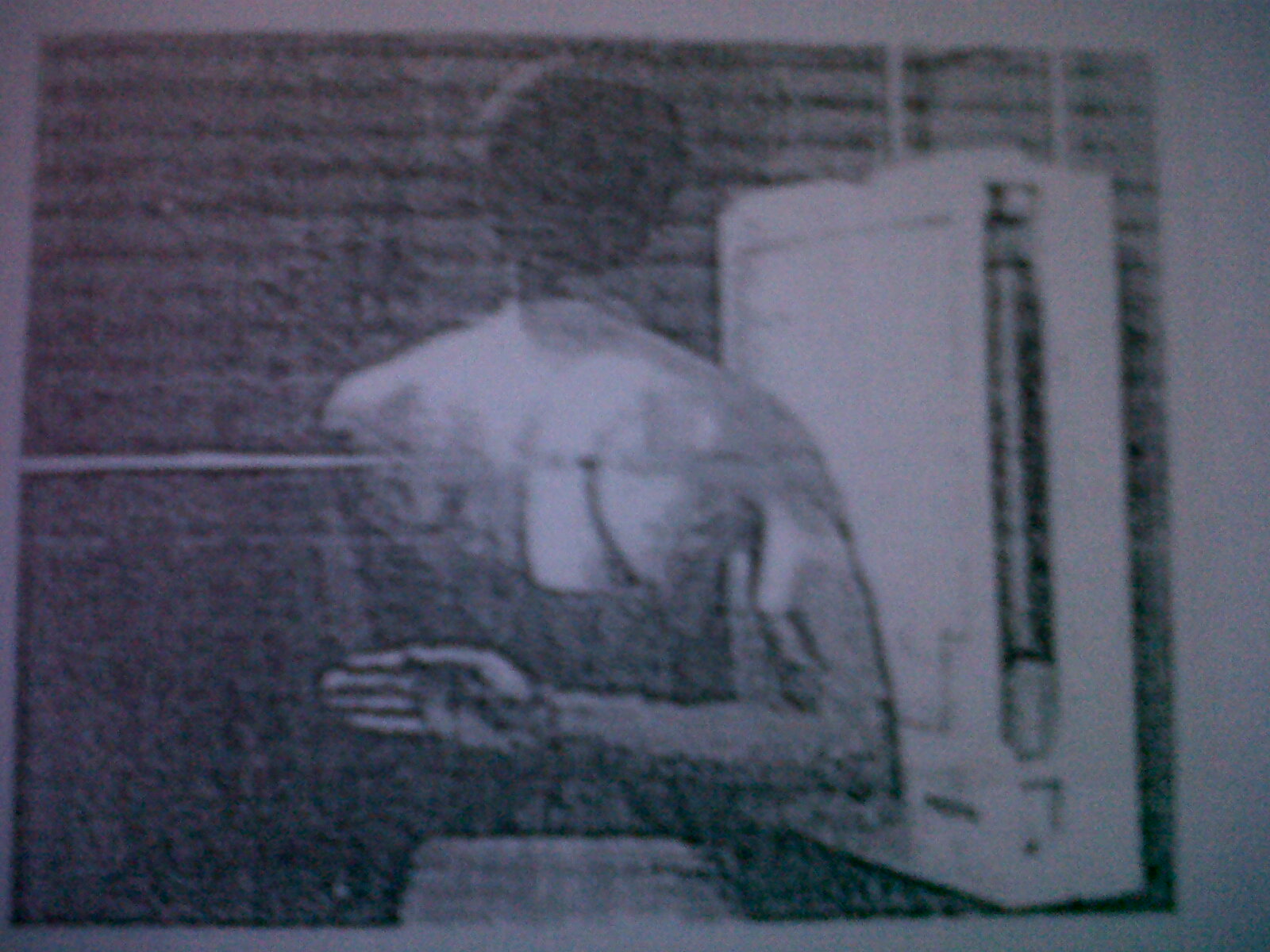 Proyeksi pemeriksaan Scapula | Aditya Radiografer