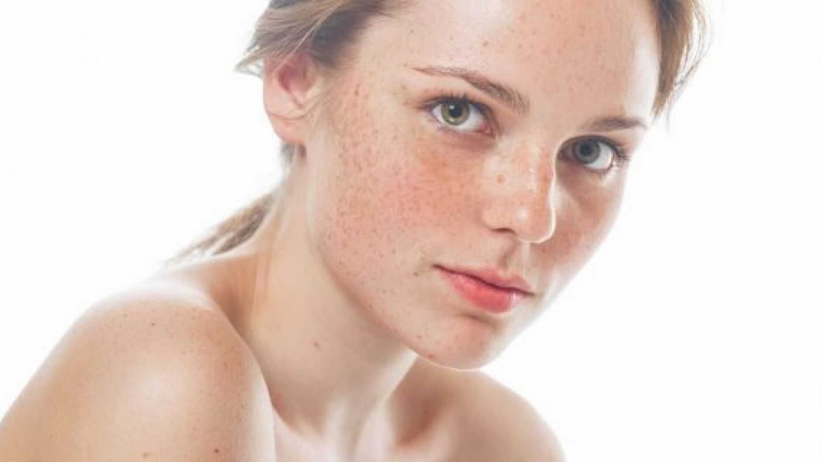 Natural Home Remedies To Remove Freckles - Natural Fitness Tips ERROR ...