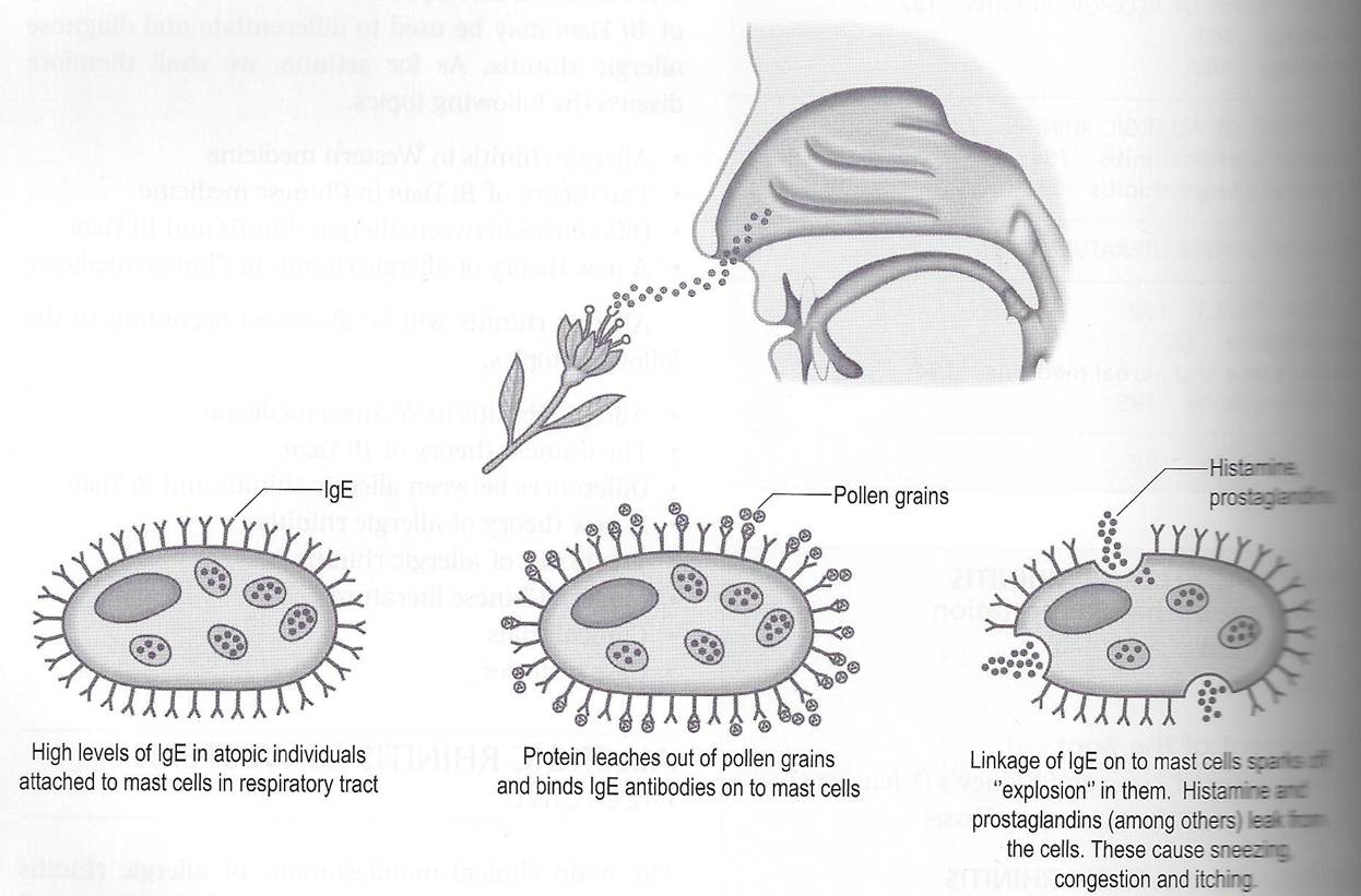 Maciocia Online: THE TREATMENT OF ALLERGIC RHINITIS ("HAY FEVER")
