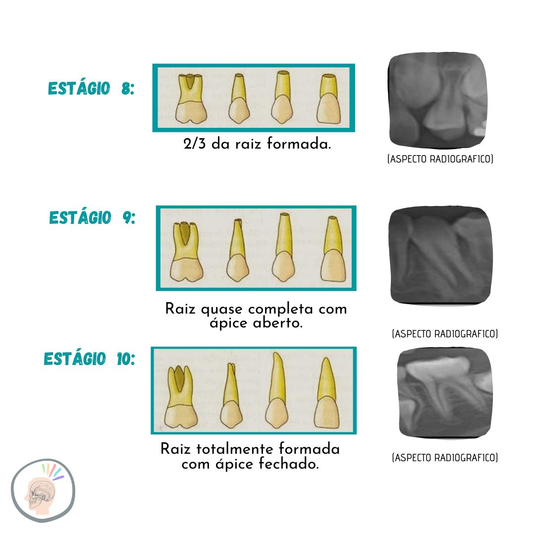 Canal da Odonto: CLASSIFICAÇÃO DE NOLLA
