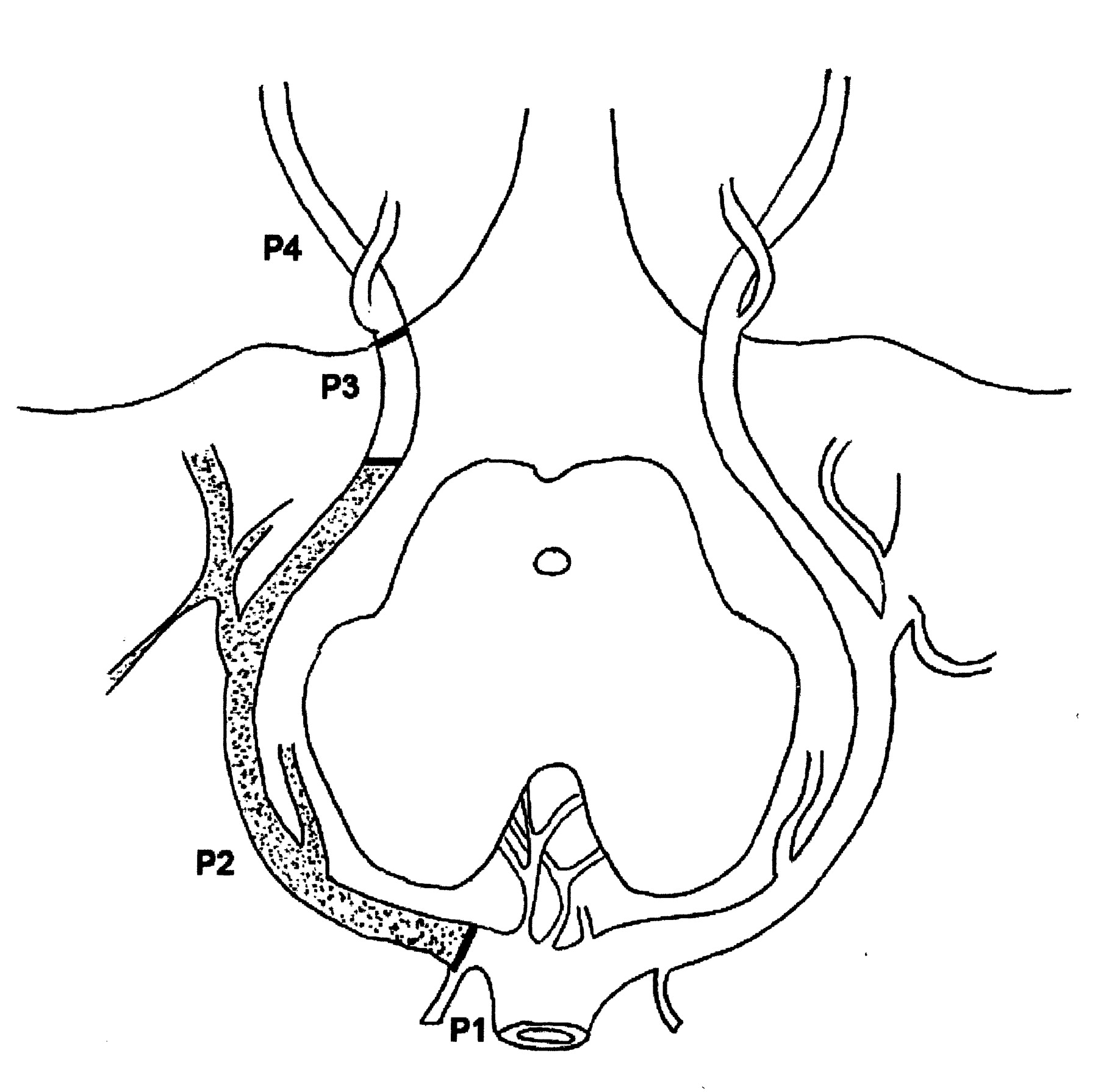 What I Learned Today: Posterior cerebral artery