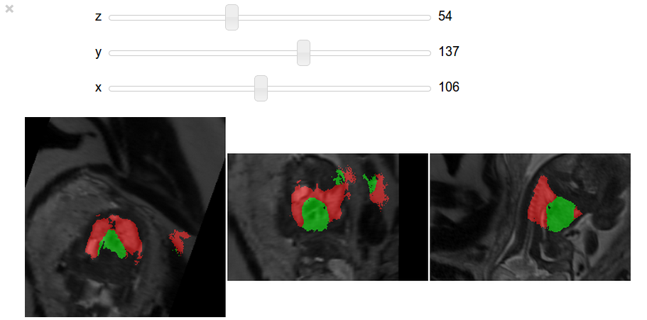 Medical Imaging & Computer Vision
