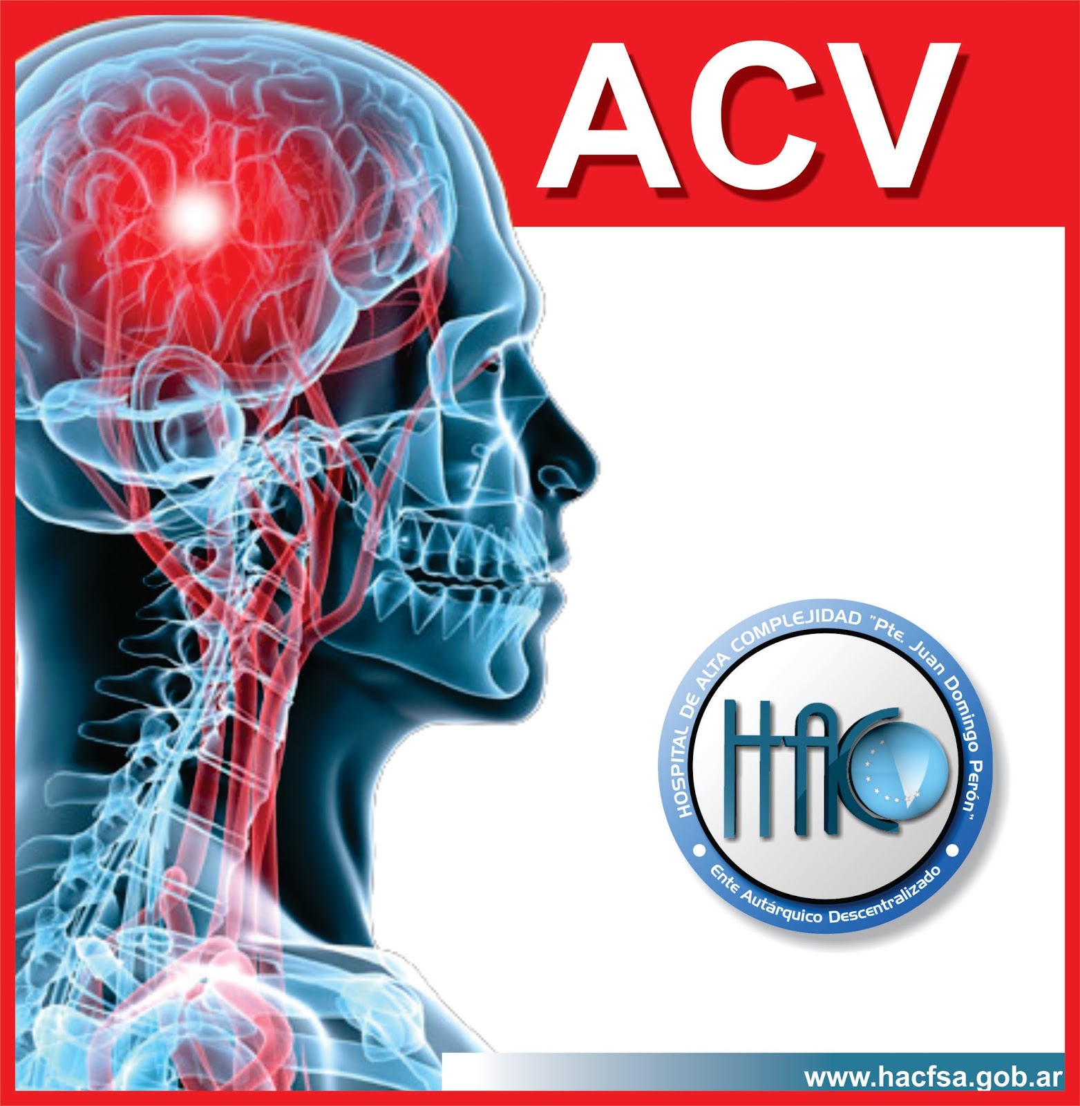 HAC: prevenir y aprender a reconocer los síntomas del ACV - Siempre Formosa