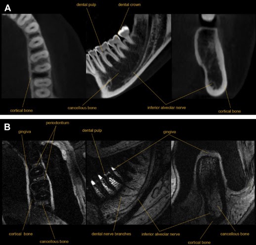 Dental MRI ( 4)