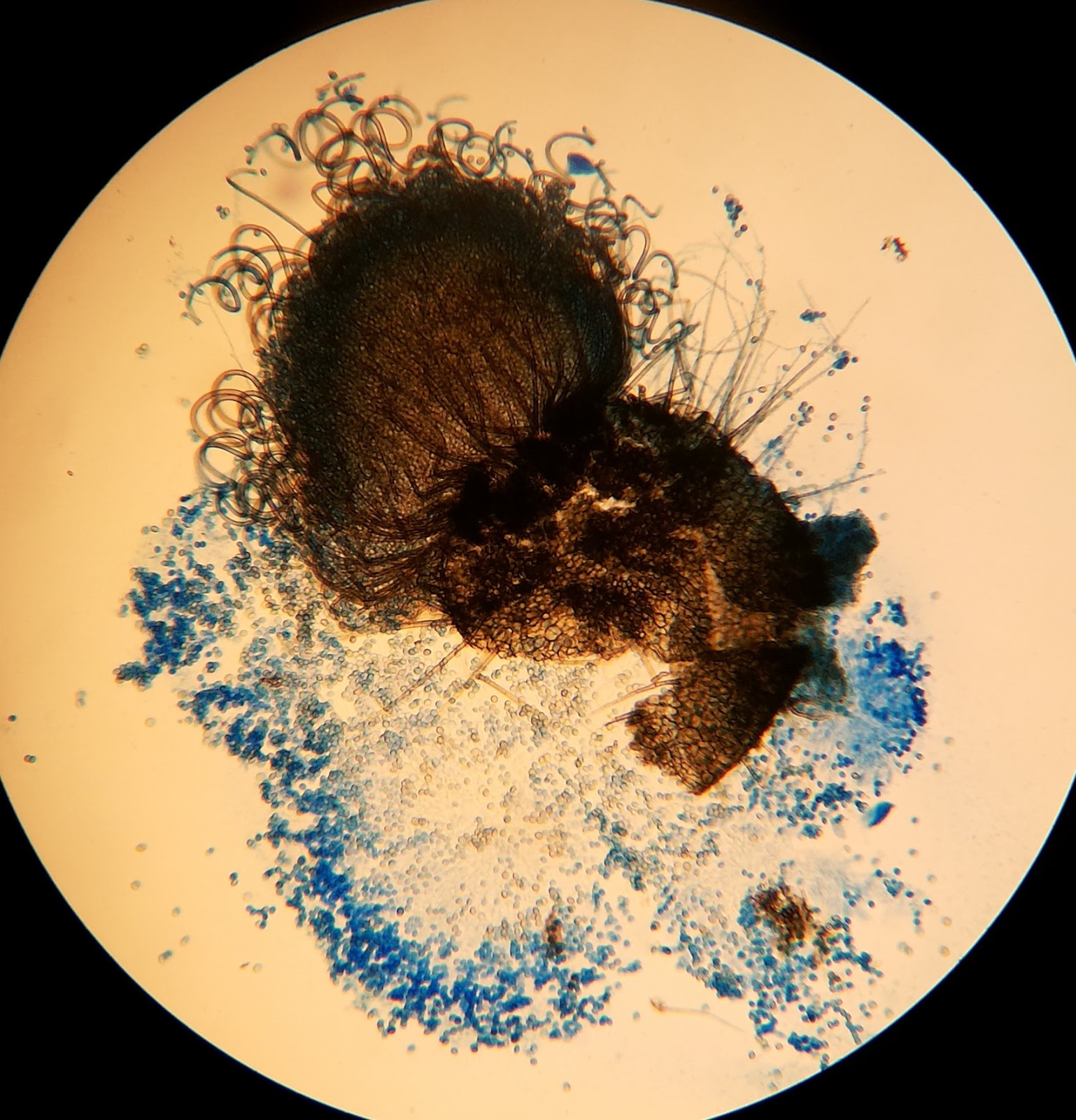 Árvores e Fungos: [Fungos] Gênero: Chaetomium