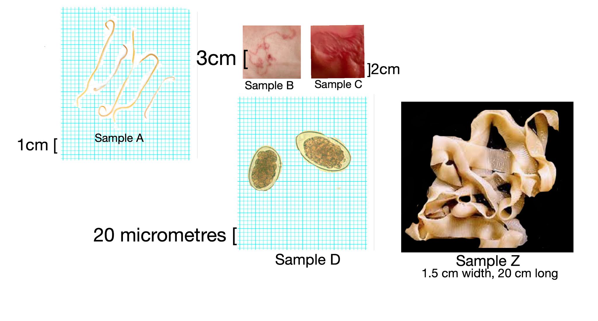 Biology Eleven: Round worms