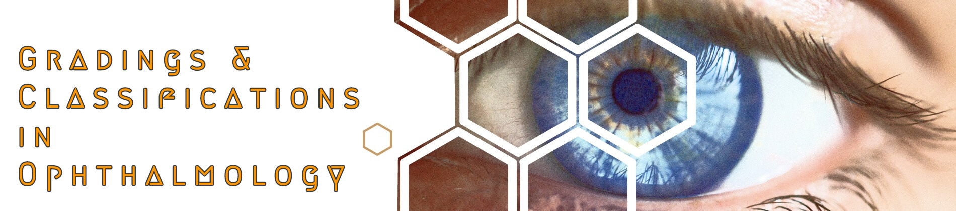 Ophthalmology Notes: Gradings & Classifications in Ophthalmology