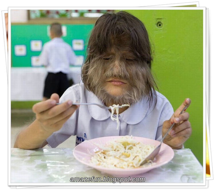 Amazing Fun: Hairy Face of Girl