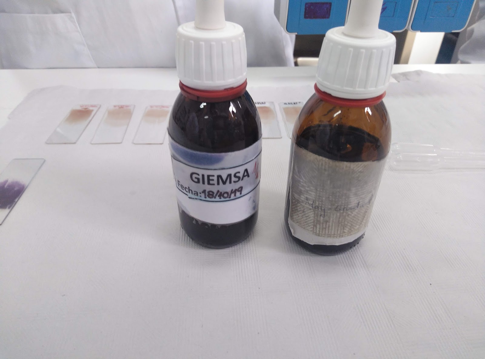 HEMATOLOGÍA: PRÁCTICA 5: TINCIÓN DE MAY-GRÜNWALD GIEMSA