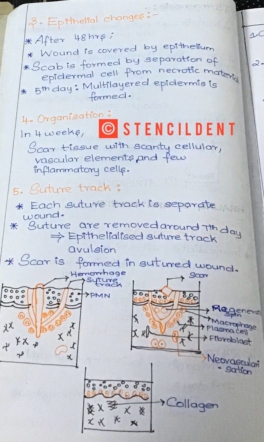 Healing of tissue -Repair,process pathology notes