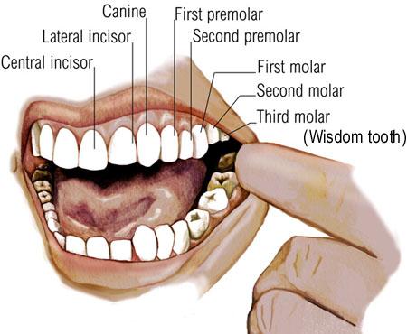 Free Online Dental Consultation: Wisdom Tooth Or Third Molar