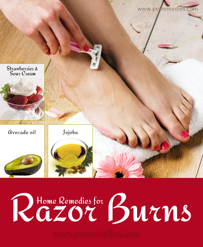 Natural Home Remedies for Razor Burns | Tips Park