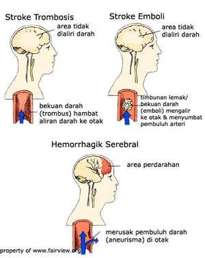 Jogjaserbaada: April 2012