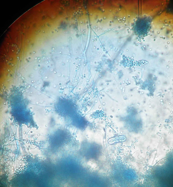 ATLAS MICOLOGIA: ASPERGILLUS USTUS COMPLEXO