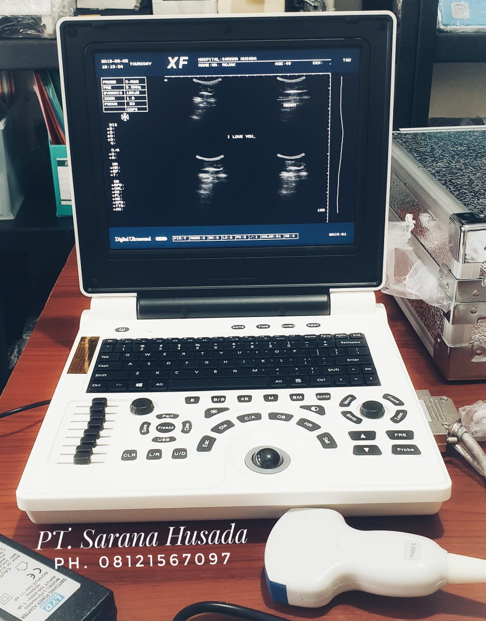JUAL USG : alat USG WIFI, Portable Laptop , USG Kebidanan , USG 3D, USG ...