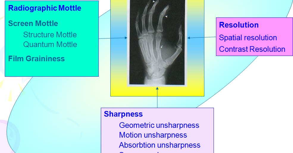 Catatan Ku: Radiografi Unsharpness