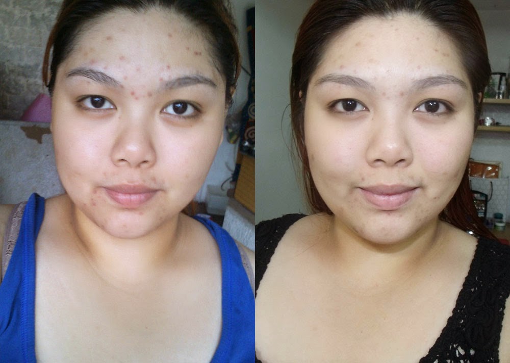 Papaya Soap Before And After