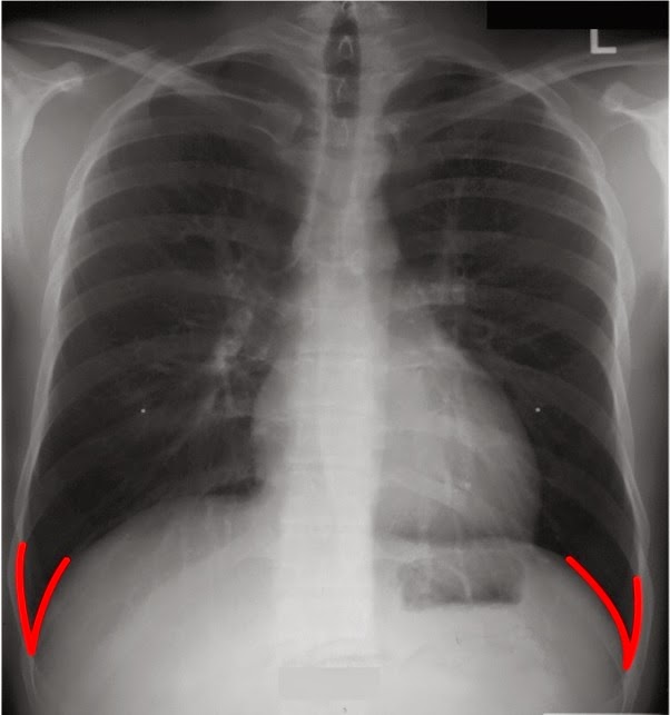 WiseMed: Radiografia de Tórax - Parte 1