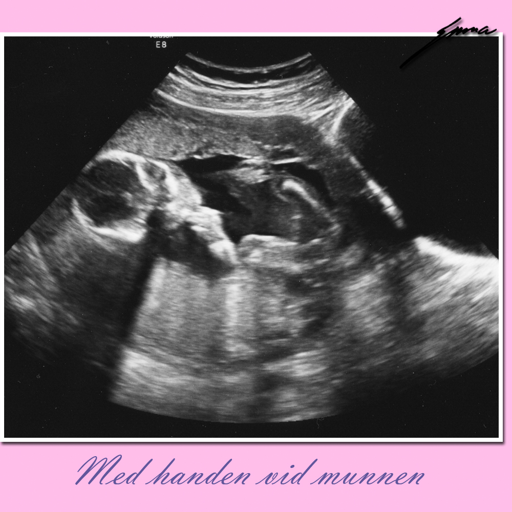 KreativaEmma : Ultraljud vecka 18