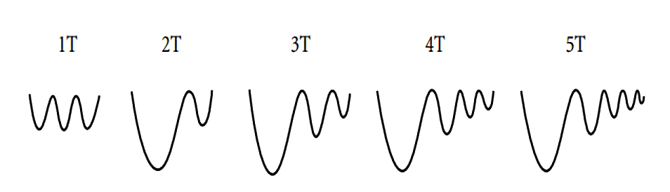กลยุทธ์การลงทุน แบบเซียน สไตล์พี่ Mark Minervini