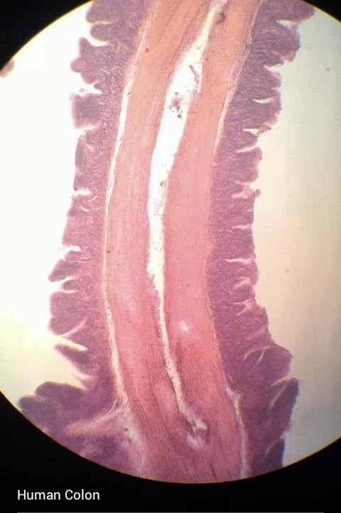 Educational Blog : Colon slides