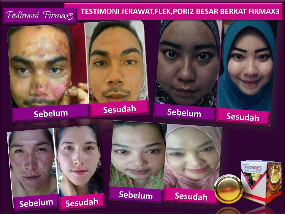Firmax3 Testimoni