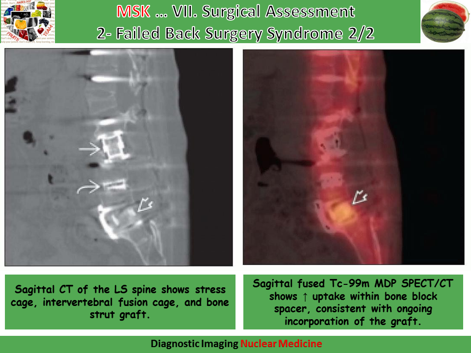 Easy Radiology: Post Surgical assessment