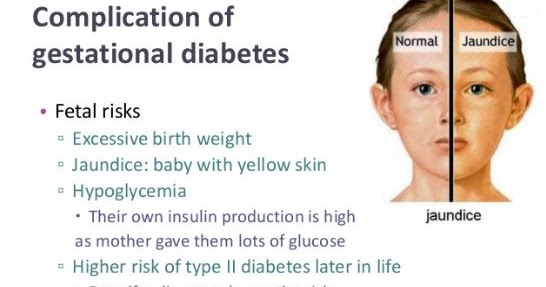 Gestational Diabetes Effects on Baby - Diabetes Suport