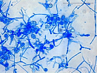 Fun With Microbiology (What's Buggin' You?): Epidermophyton floccosum