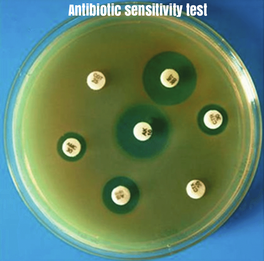 Antibiotic sensitivity-test and result ~ Medical Microbiology