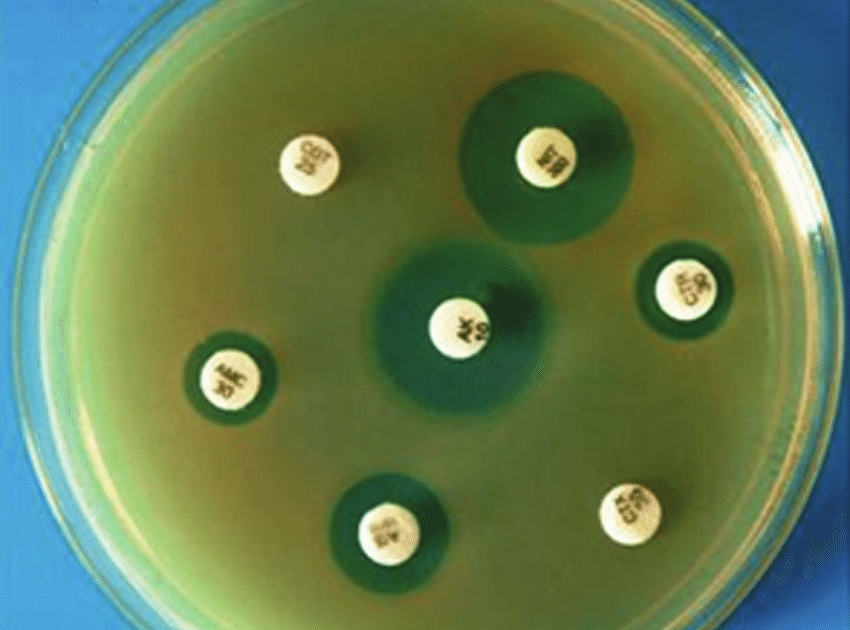 Antibiotic sensitivity-test and result ~ Medical Microbiology