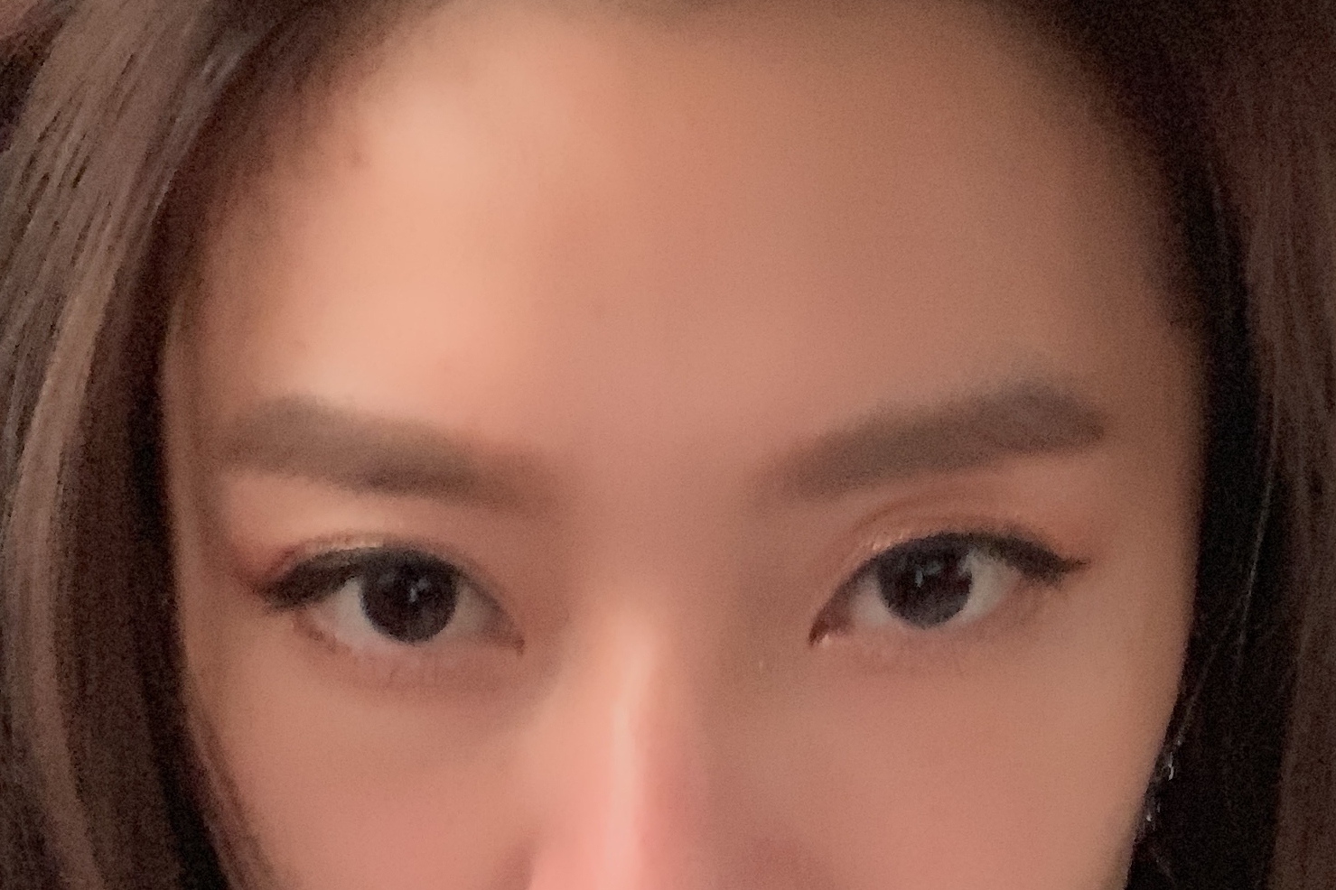 WELCOME TO MY DREAM: The Best Eye Surgeon Doctor - Dr. Alice Goh Siew Ching