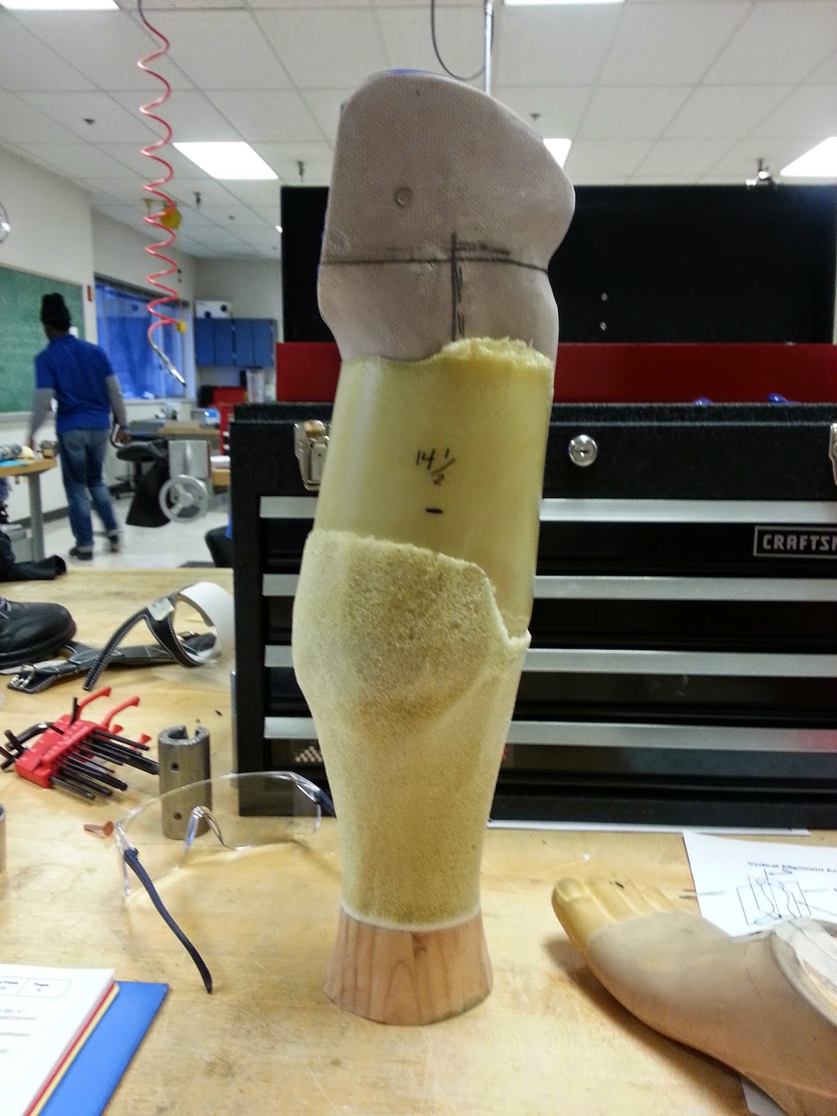 Prosthetic Projects: PTB Exoskeletal Prosthesis