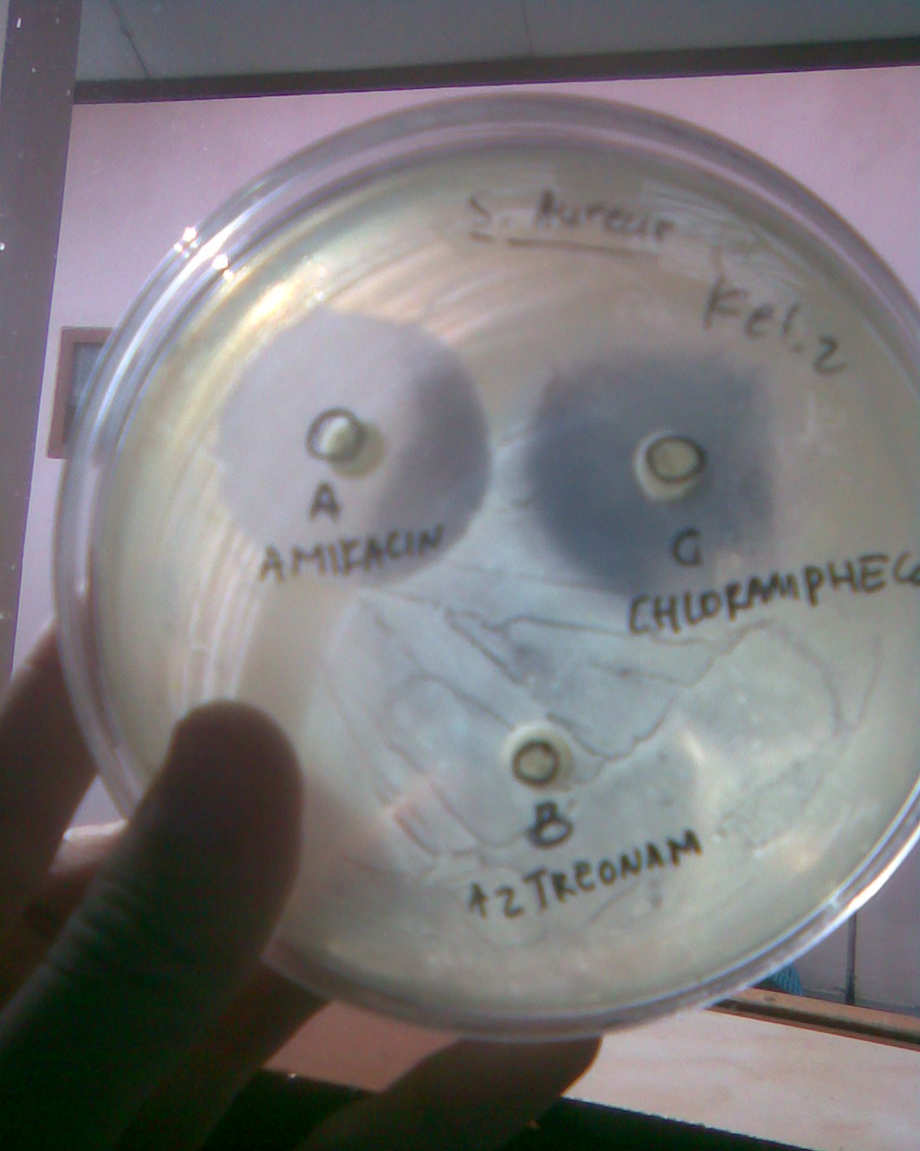 Uji Sensitivitas S. aureus dan S. thypi