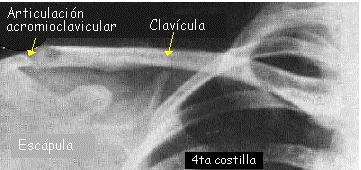 Estudios radiográficos que comprenden miembros inferiores y superiores ...
