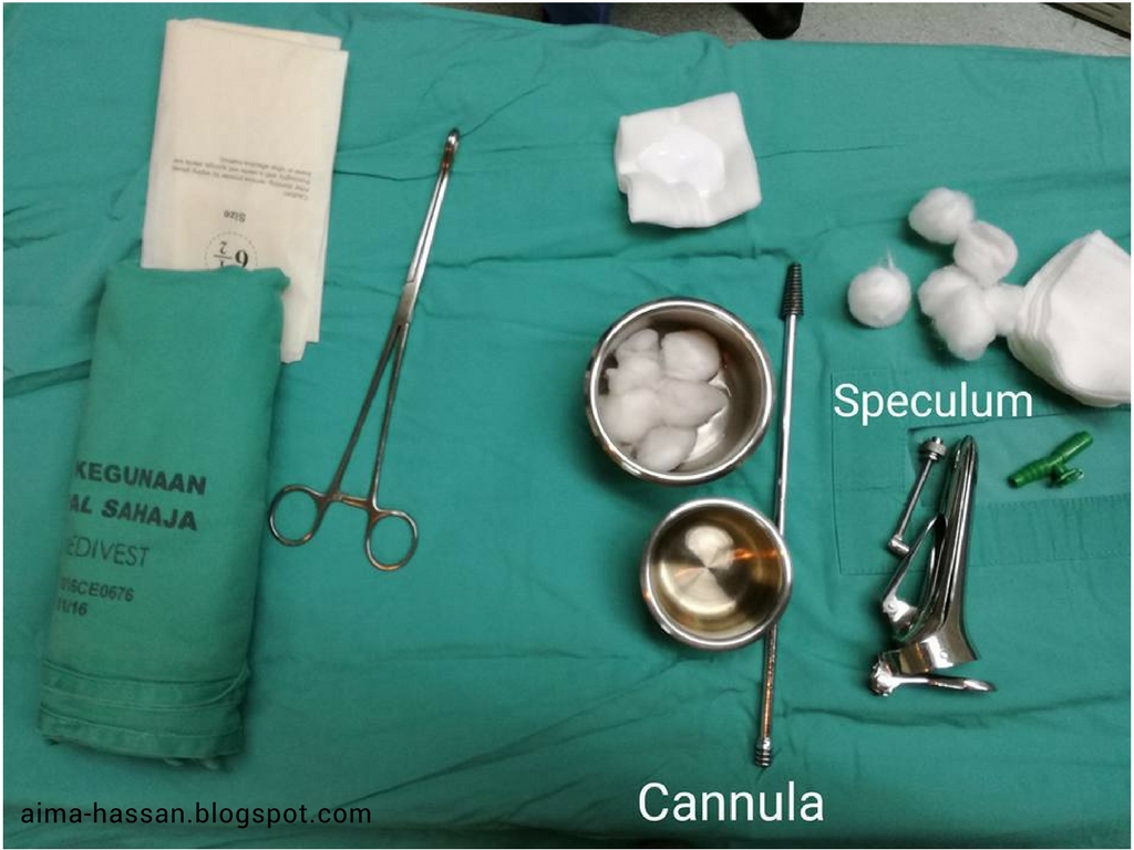 HSG - TIUB SAYA TERSUMBAT KE DOKTOR?