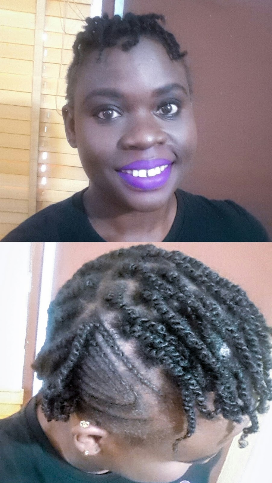 Unrealistic Expectation Regrowing Bald Edges || Natural Hair Problems ...