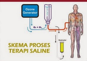 Solusi Sehat Dari Klinik Ozon dan Anti Aging Terbaik - elisakaramoy's blog