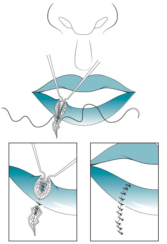 Facial Laceration Case File