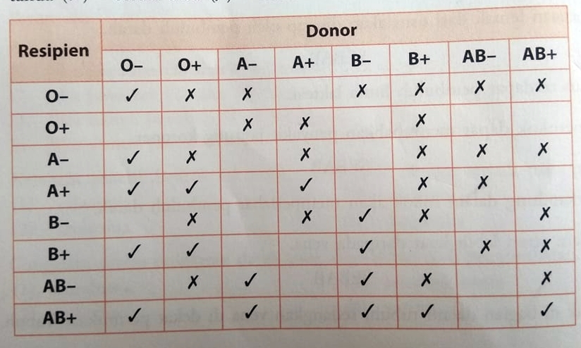 Lengkapi tabel kesesuaian transfusi darah berdasarkan sistem ABO dan ...
