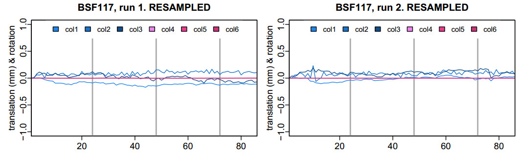 MVPA Meanderings: multiband acquisition sequence testing: respiration