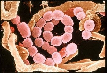 חיידקים, נגיפים, ושאר "ירקות" - בלוג של ביולוג - ד"ר דרור בר-ניר ...