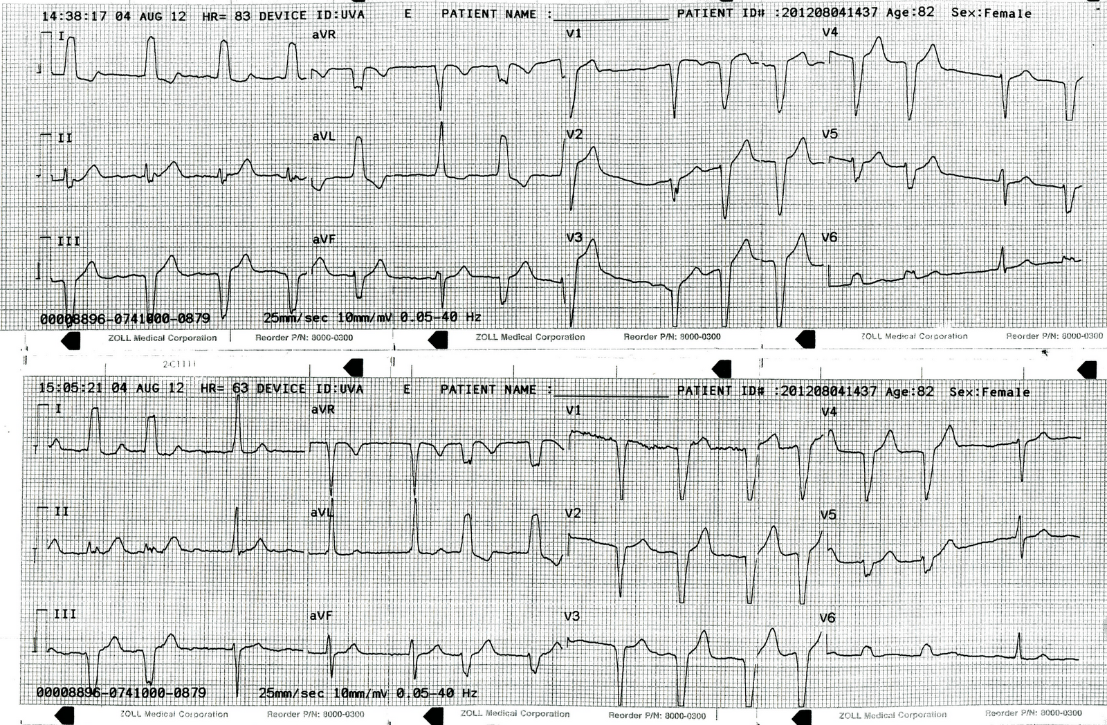 Surviving Paramedic School: First Chest Pain Call...Updated