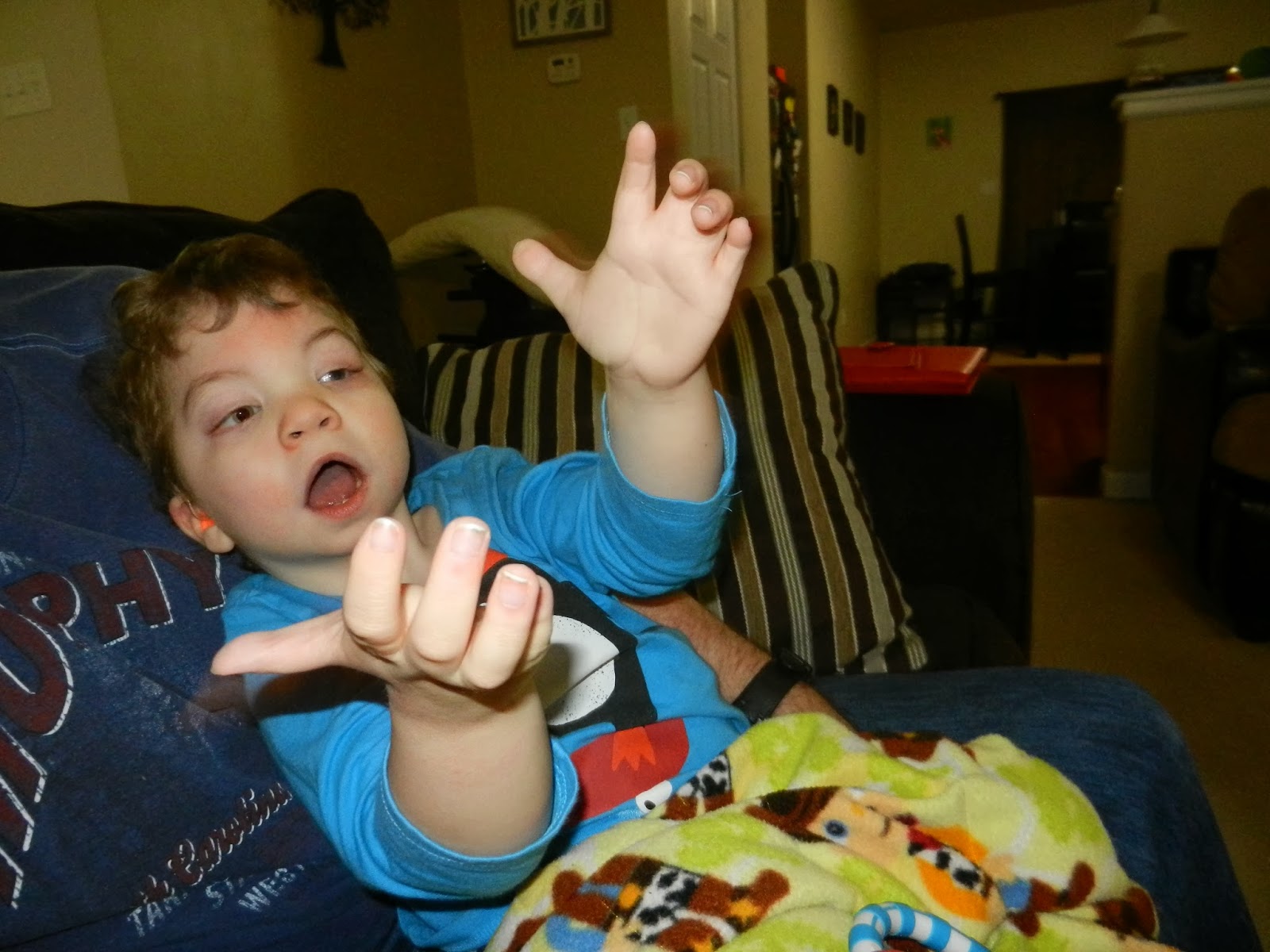 THIS I KNOW | a mommy blog about our son with special needs: Congenital ...