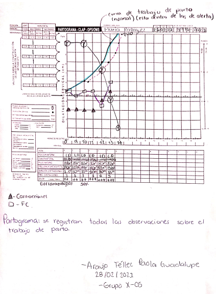 Atención del parto normal y pélvico. -Actividad partograma