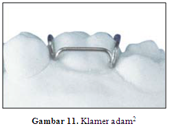 Me: orthodonti